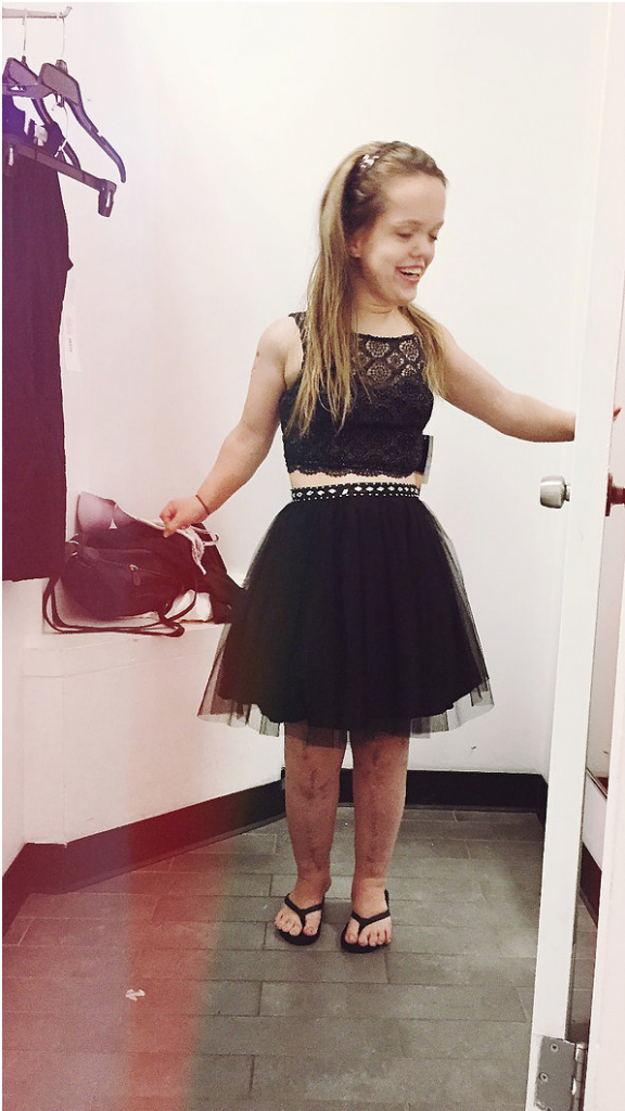 Life After Lengthening – Chandler C. Crews